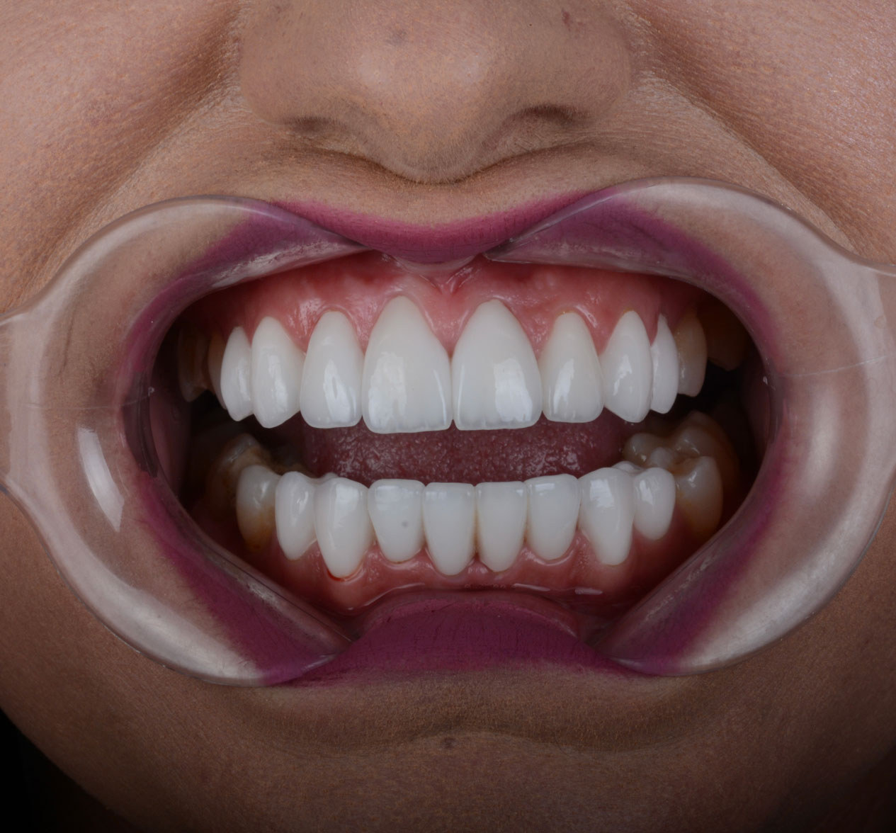 Dental Space Kotež,Beograd - Centar za estetsku stomatologiju