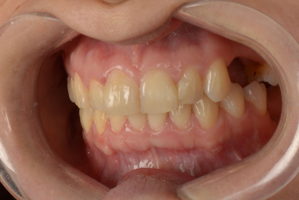 Dental Space Kotež,Beograd - Centar za estetsku stomatologiju